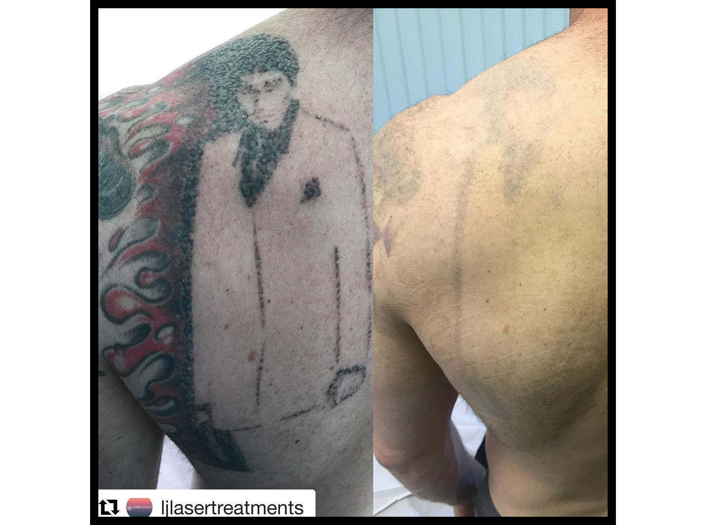 Target Field Tattoos