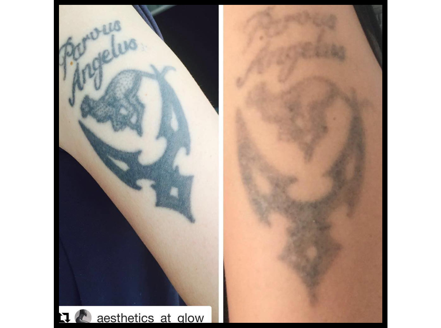 Target Field Tattoos