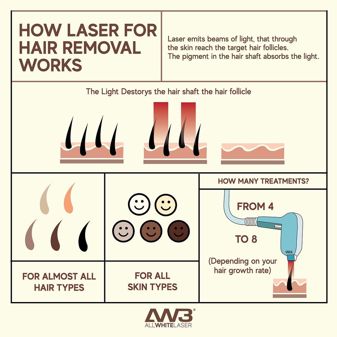How Laser Hair Removal Works Allwhite Laser Aw3®